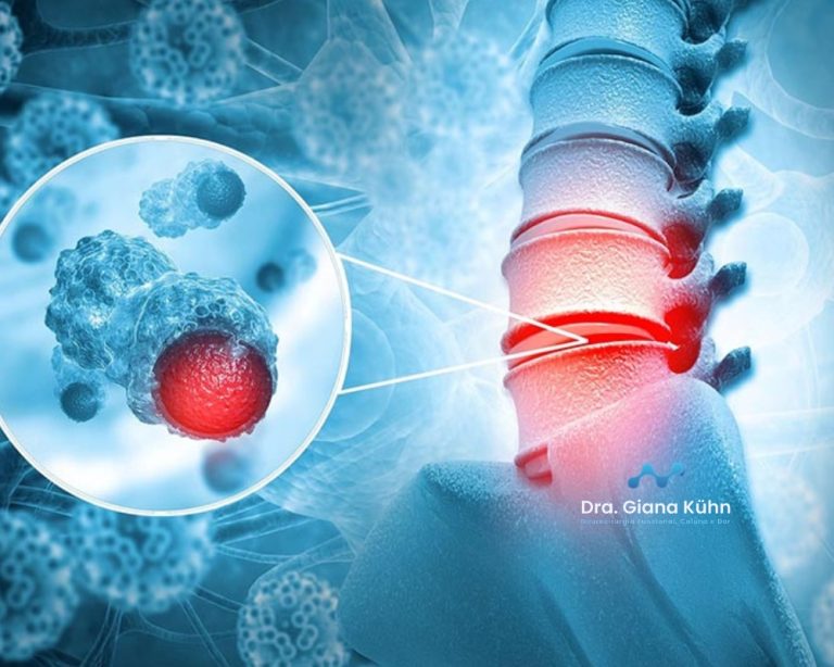 Conheça os Tipos de Tumores Mais Comuns na Coluna Vertebral e as Opções ...